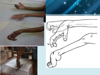 Pros and cons of pop application | PPTX