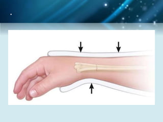 Pros and cons of pop application | PPTX