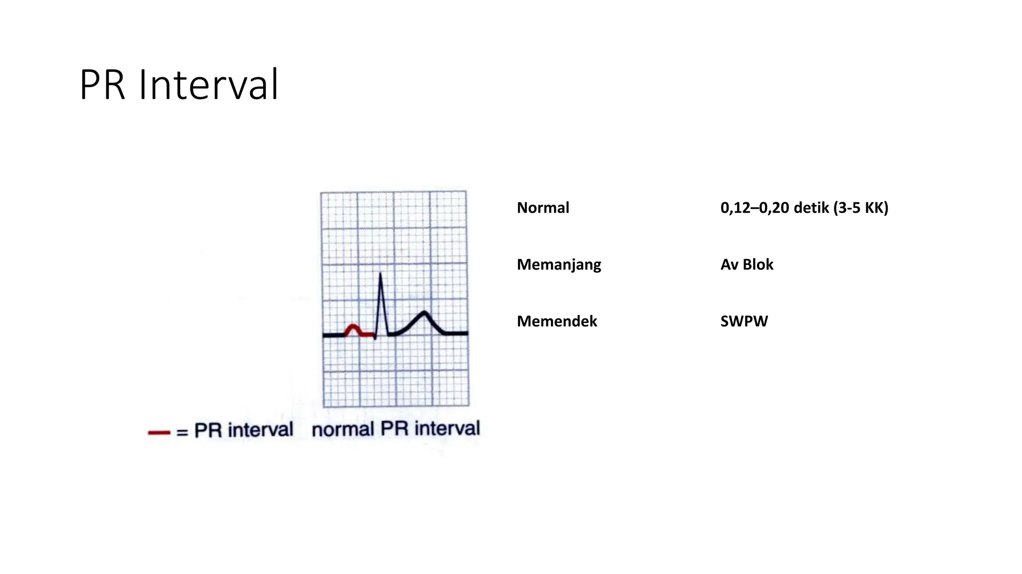 PROSEDUR PEMASANGAN EKG PADA KEPERAWATAN.pptx