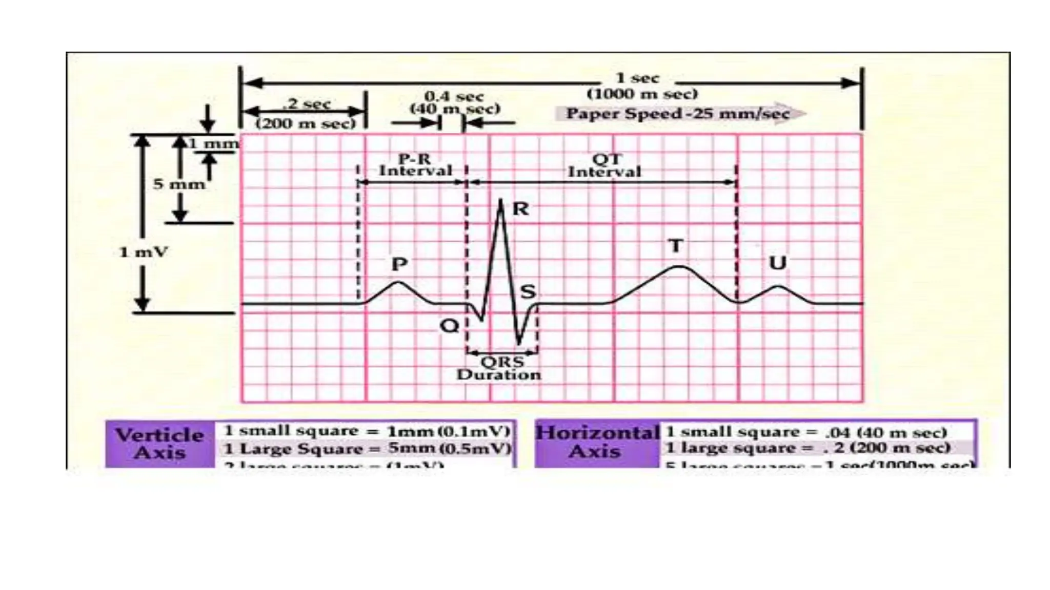 PROSEDUR PEMASANGAN EKG PADA KEPERAWATAN.pptx