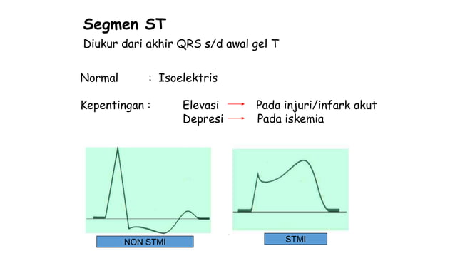 PROSEDUR PEMASANGAN EKG PADA KEPERAWATAN.pptx