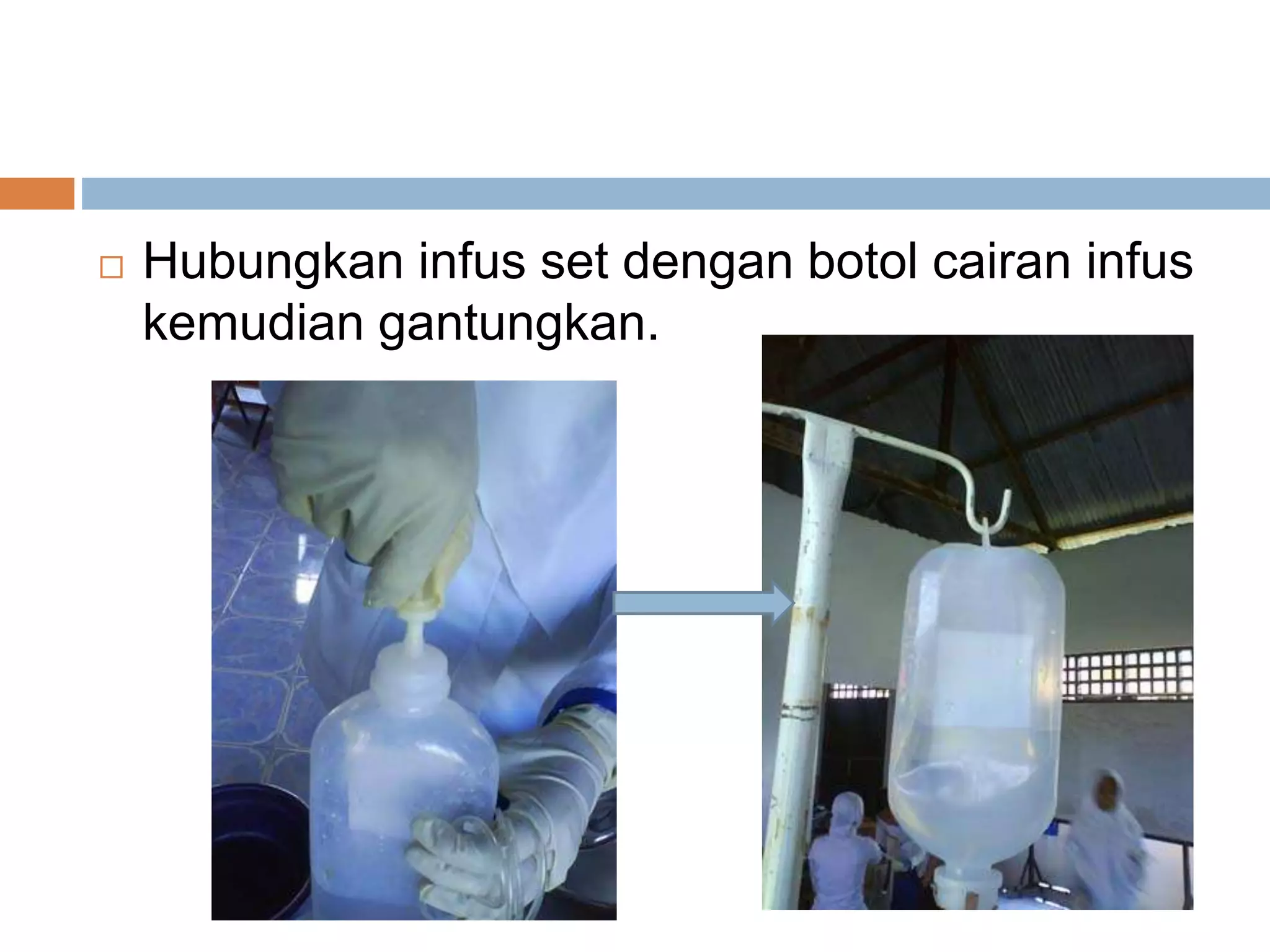 Prosedur Pemasangan Infus.pptx