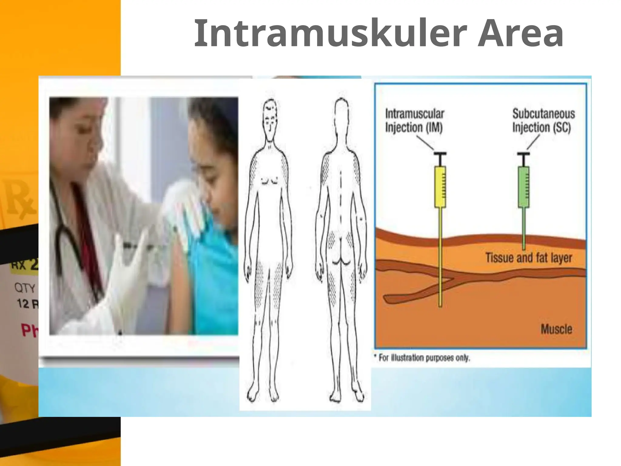 Prosedur pemberian Obat (IC, IM, SC, IV).pptx