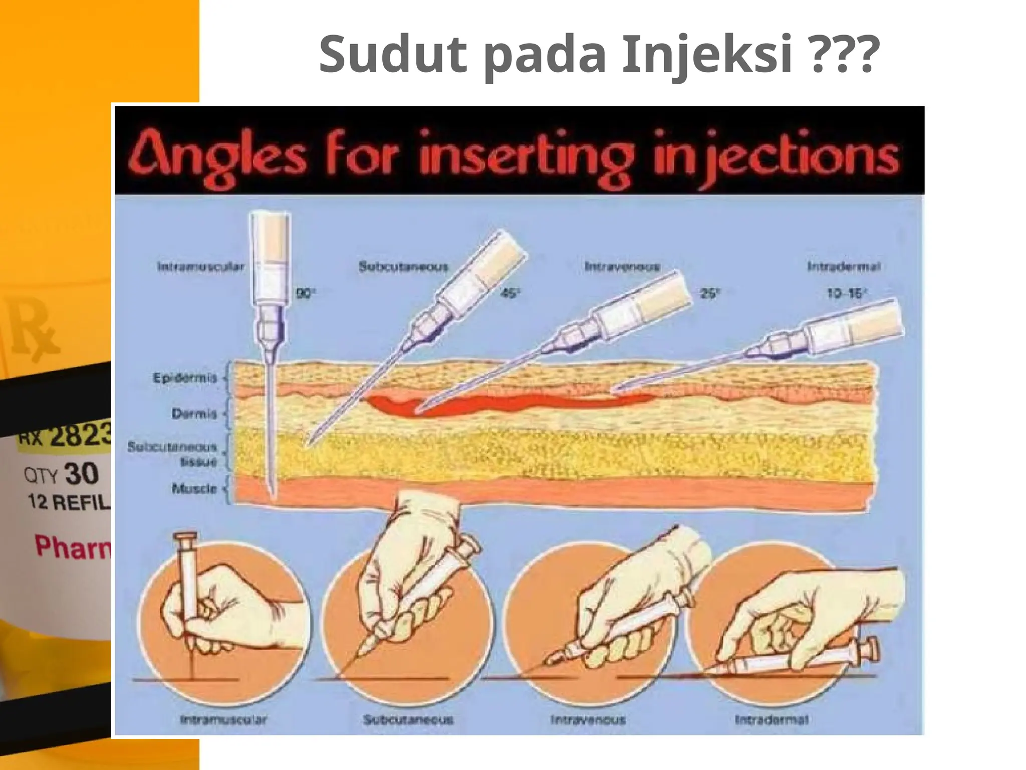 Prosedur pemberian Obat (IC, IM, SC, IV).pptx