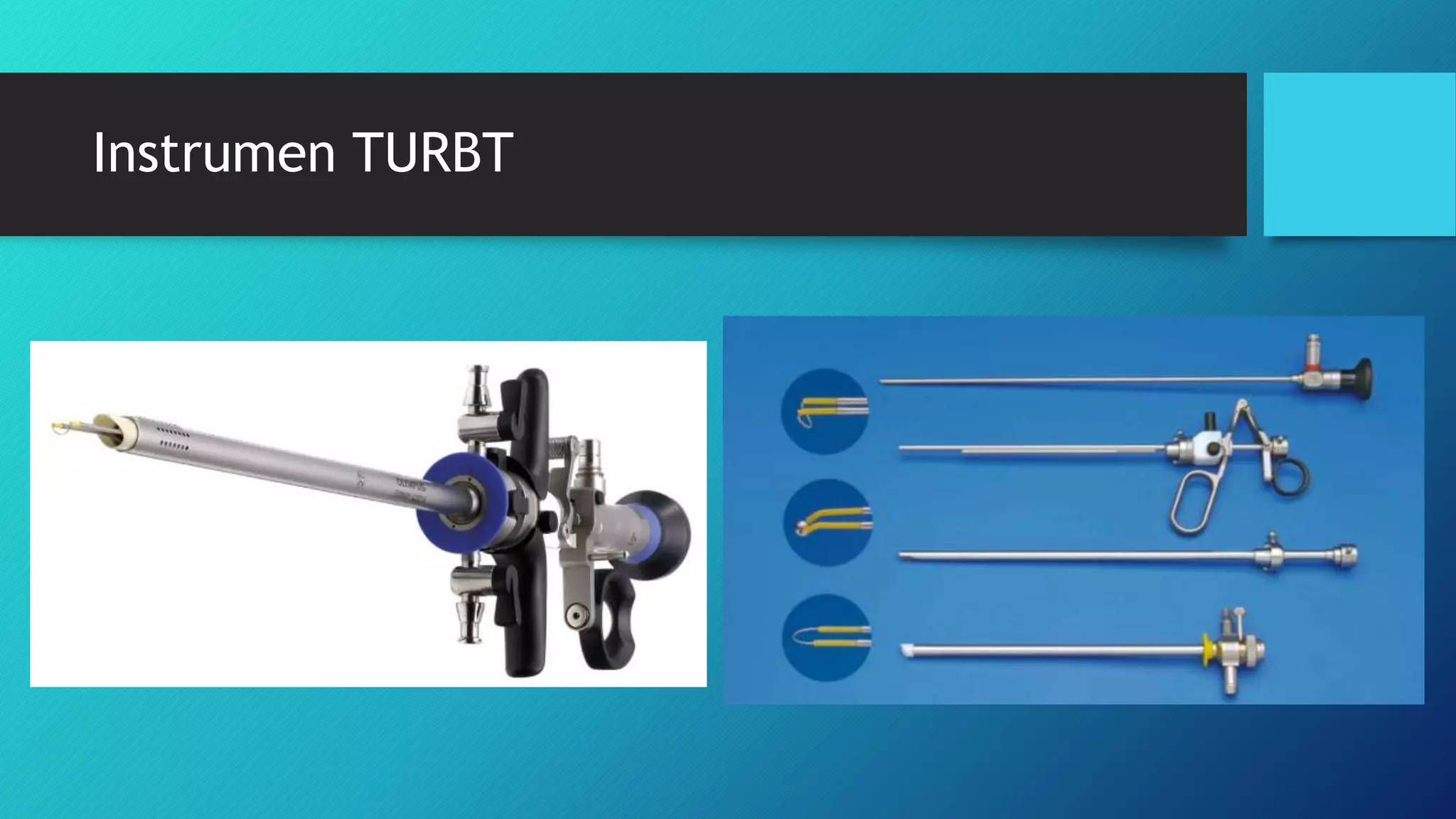 TURBT PROCEDURE | PPTX