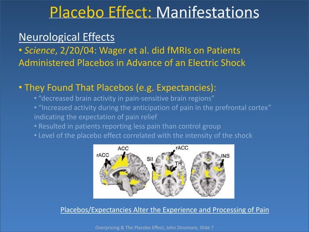 Price Perception & The Placebo Effect in Marketing | PPT