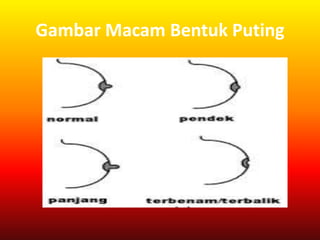 Proses laktasi dan menyusui,ppt | PPT