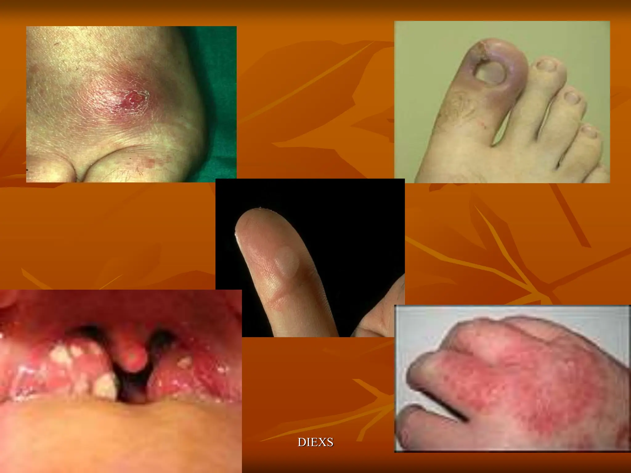 proses peradangan pada sistem tubuh manusia | PPT