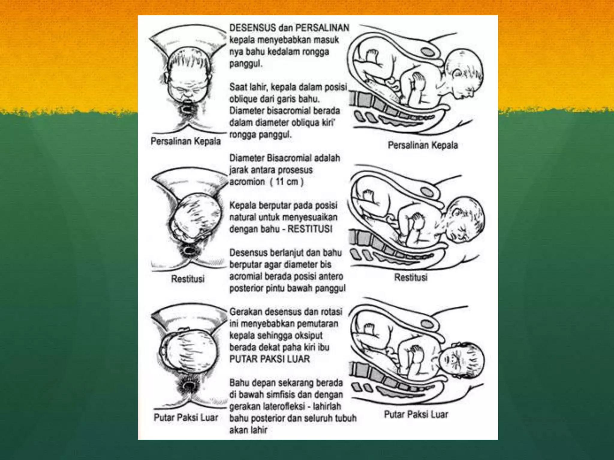 Proses persalinan normal | PPTX