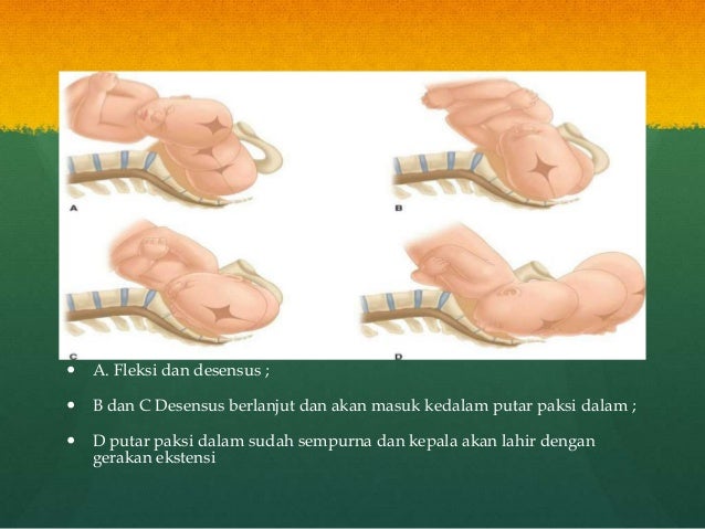 Dalam dunia medis, persalinan normal, atau persalinan spontan ...