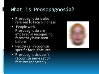 Prosopagnosia | PPT