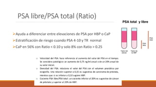 Herramientas para el diagnóstico del cáncer de próstata desde Atención ...