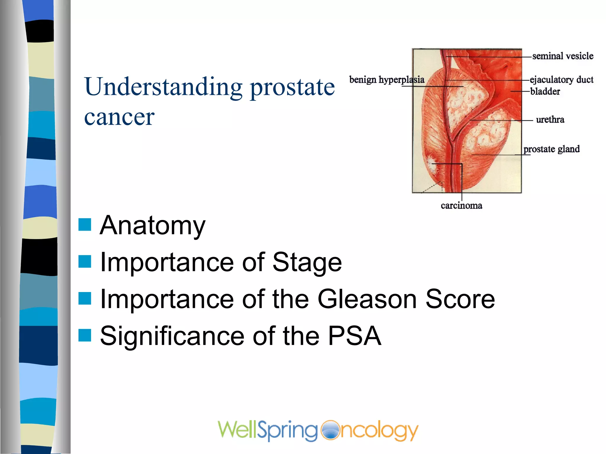 Prostate Cancer | PPT