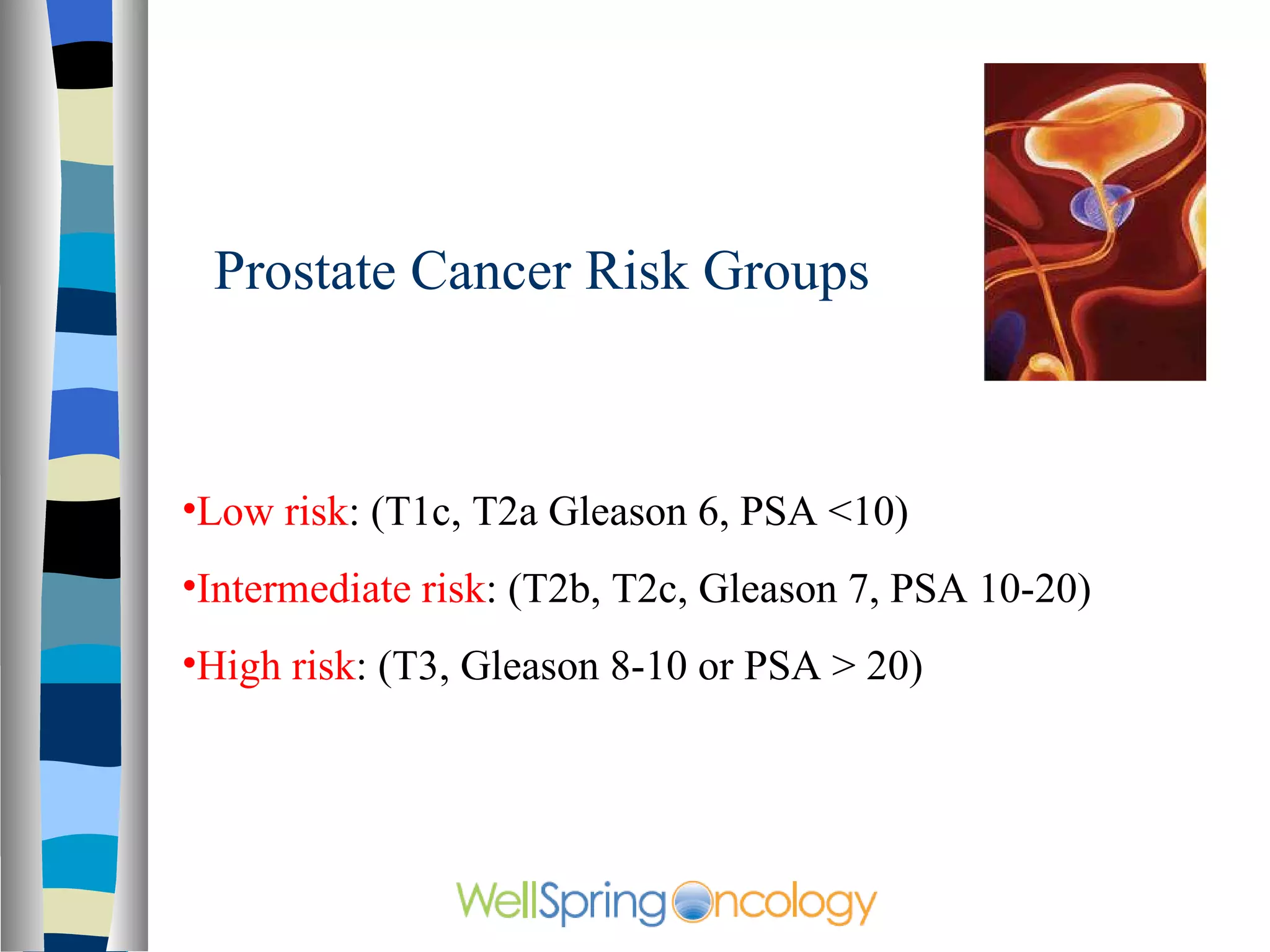 Prostate Cancer | PPT