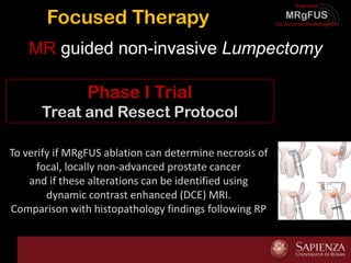 MRgFUS in Locally Non-Advanced Prostate Cancer | PPT