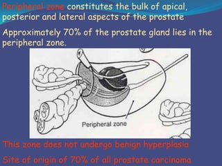 Surgical Anatomy of Prostate | PPTX