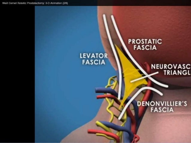 Surgical Anatomy of Prostate
