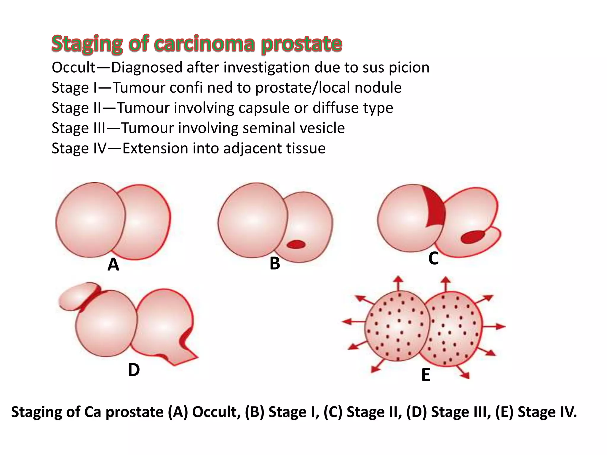 Prostate Anatomy,physiology & Pathology | PPTX