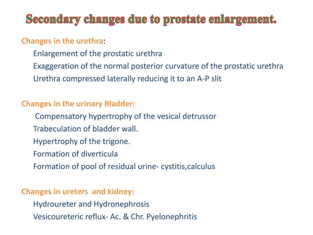 Prostate Anatomy,physiology & Pathology | PPTX | Reproductive Health ...