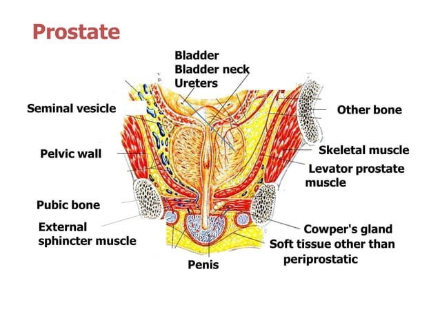 Prostate.pptx