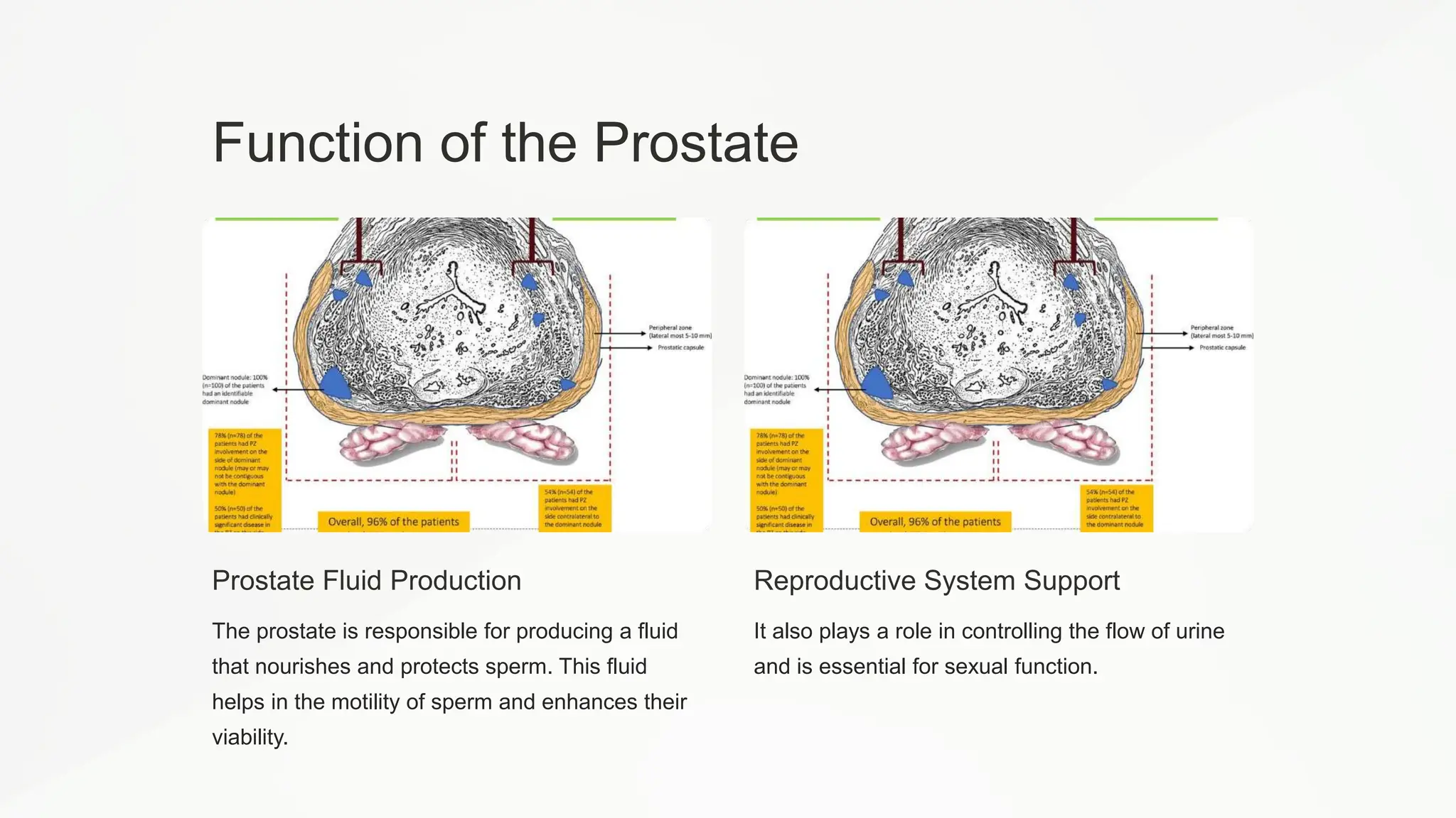 prostate.pptx