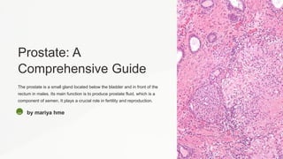 prostate.pptx