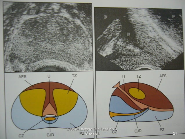 Prostate anatomy, embryology | PDF | Pregnancy | Reproductive Health