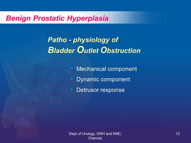 Prostate BPH- evaluation & management | PPT