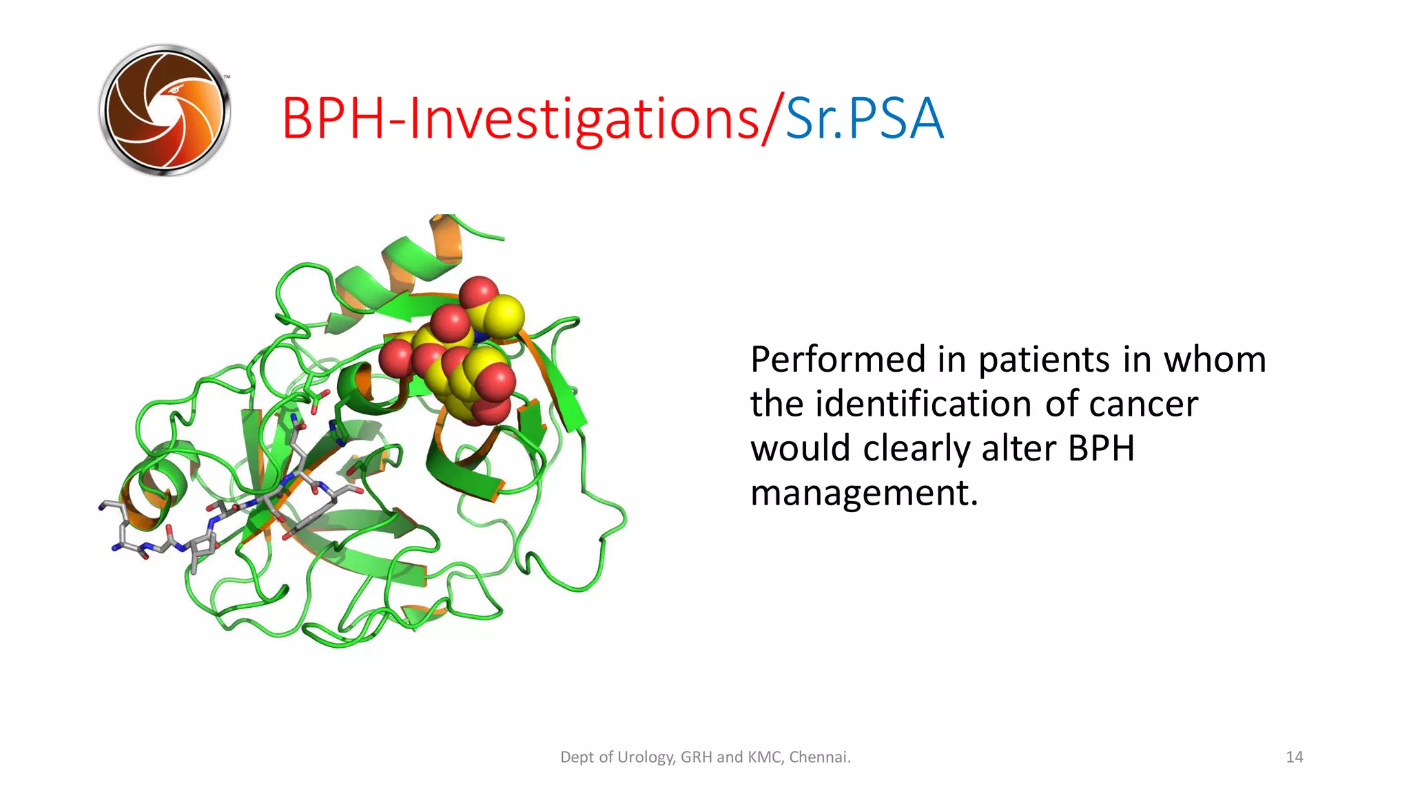 Prostate Benign Prostatic Hyperplasia(BPH)- overview | PDF