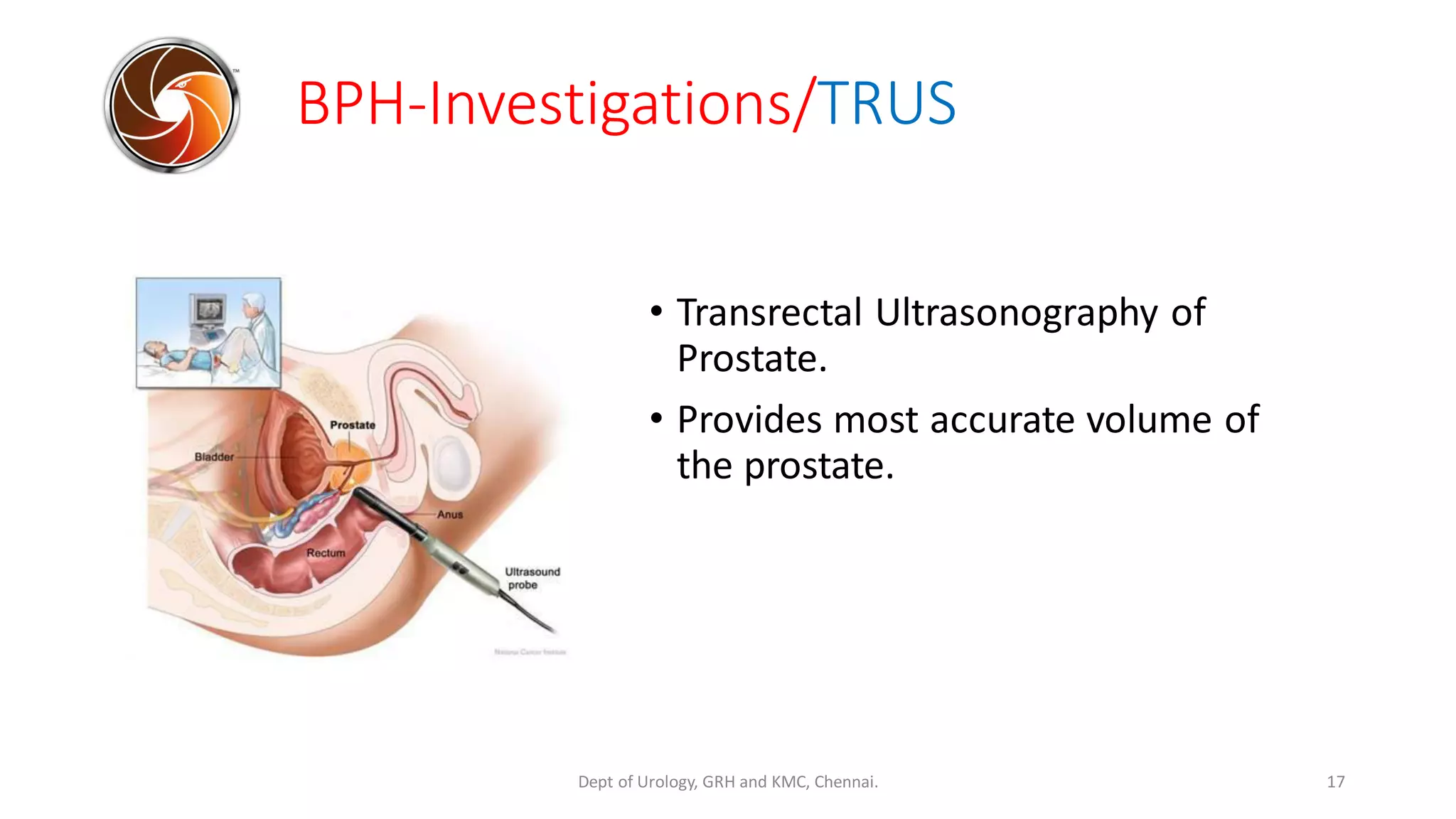 Prostate Benign Prostatic Hyperplasia(BPH)- overview | PDF