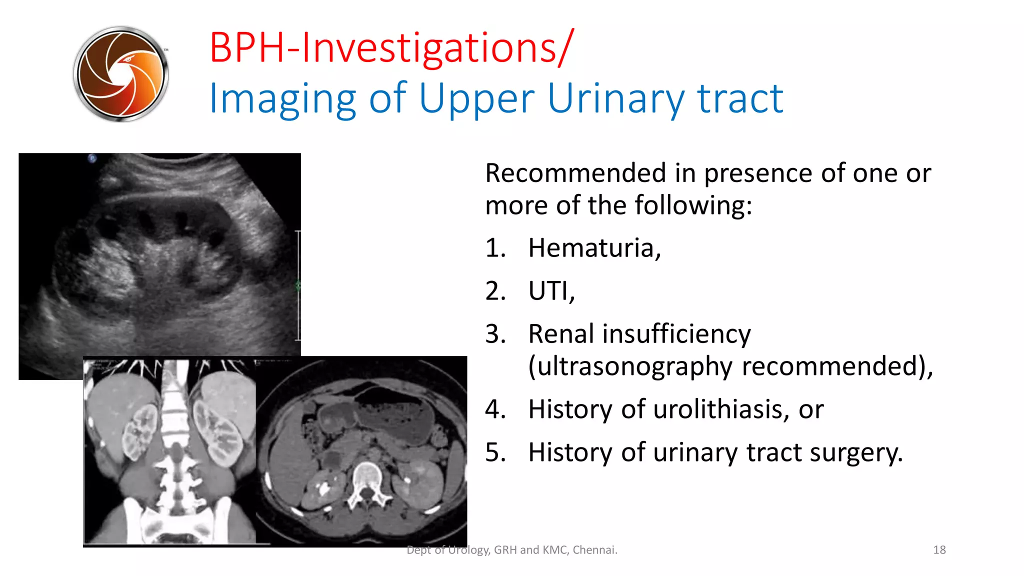 Prostate Benign Prostatic Hyperplasia(BPH)- overview | PDF