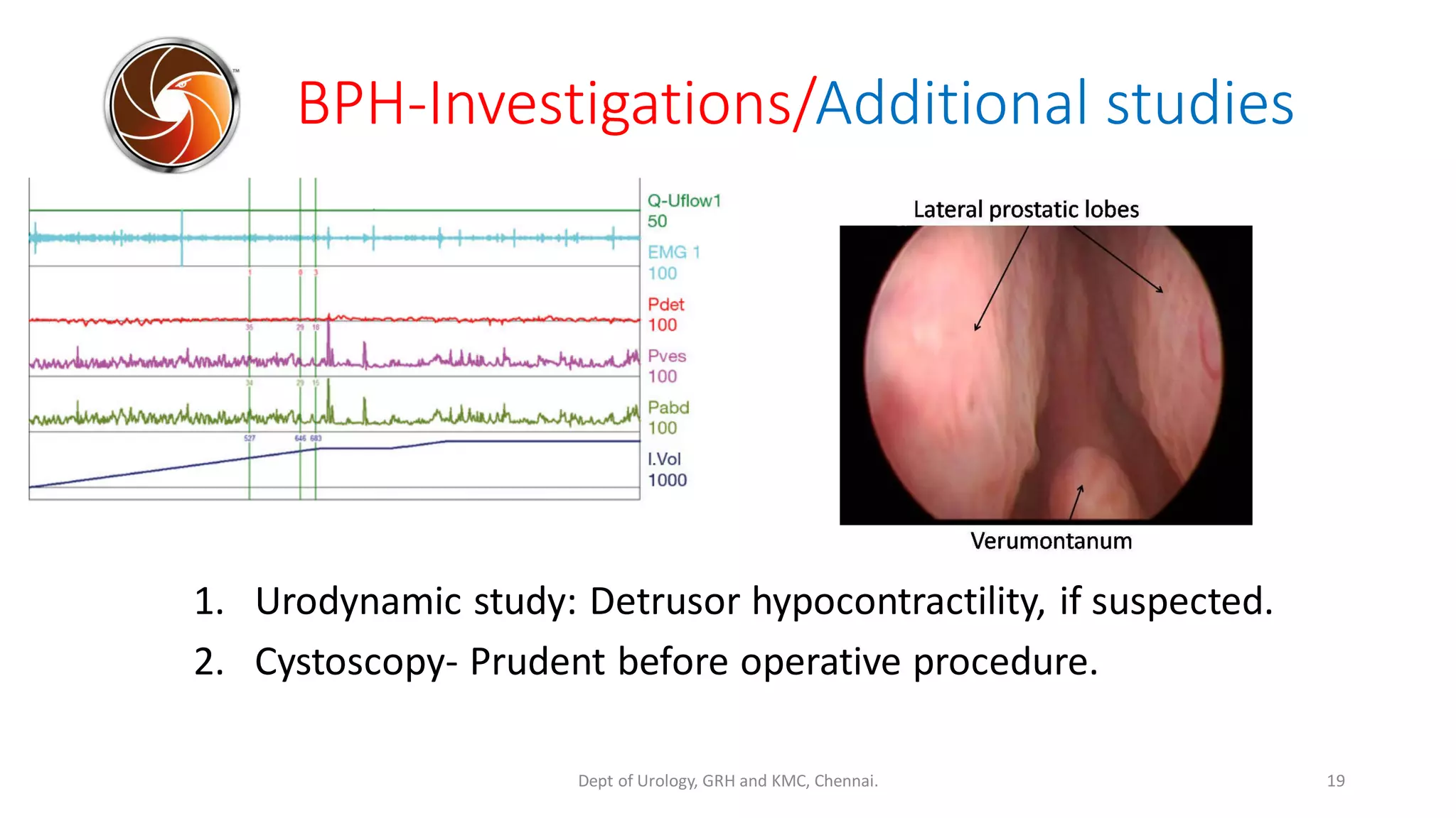 Prostate Benign Prostatic Hyperplasia(BPH)- overview | PDF