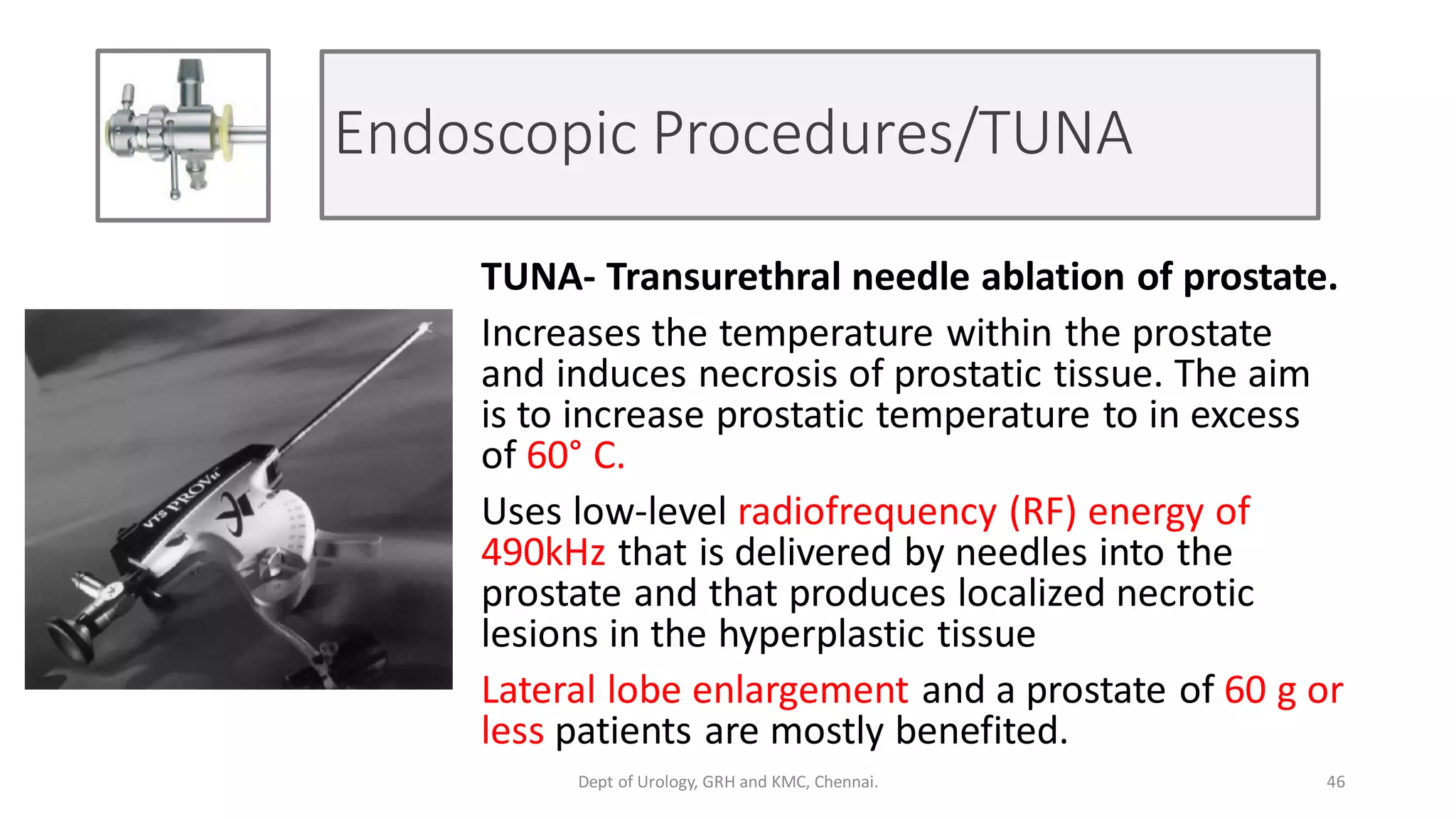 Prostate Benign Prostatic Hyperplasia(BPH)- overview | PDF