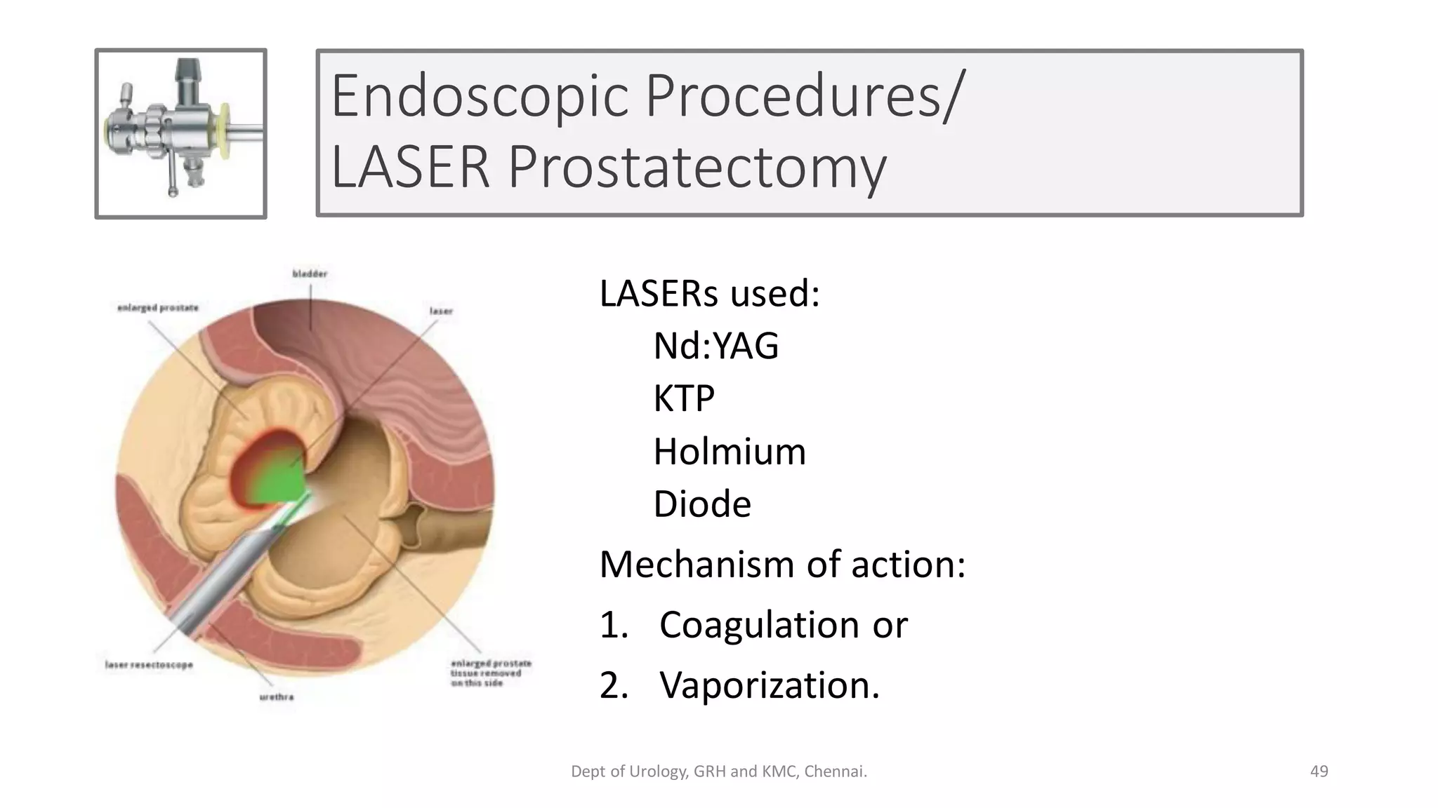 Prostate Benign Prostatic Hyperplasia(BPH)- overview | PDF