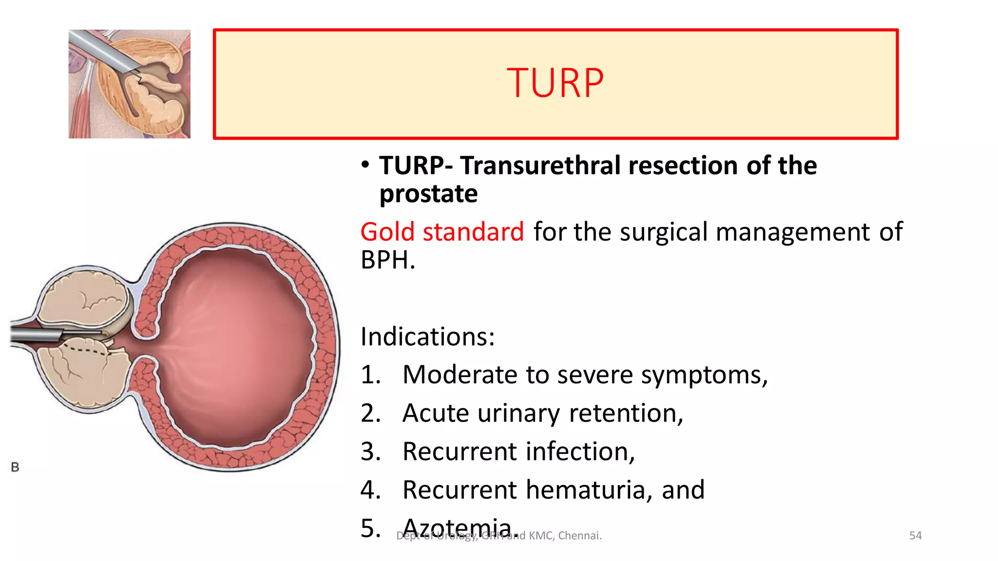 Prostate Benign Prostatic Hyperplasia(BPH)- overview | PDF
