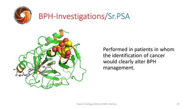 Prostate Benign Prostatic Hyperplasia(BPH)- overview | PDF | Sexual ...