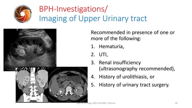 Prostate Benign Prostatic Hyperplasia(BPH)- overview | PDF | Sexual ...
