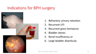 Prostate Benign Prostatic Hyperplasia(BPH)- overview | PDF