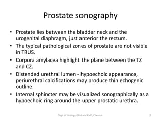Prostate carcinoma- Prostate biopsy | PDF