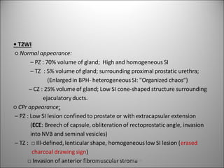 Prostate carcinoma- diagnosis and staging | PDF
