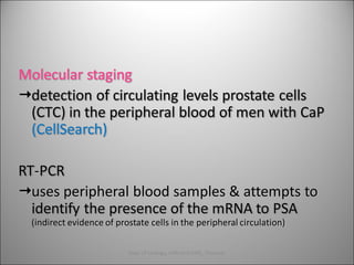 Prostate carcinoma- diagnosis and staging | PDF
