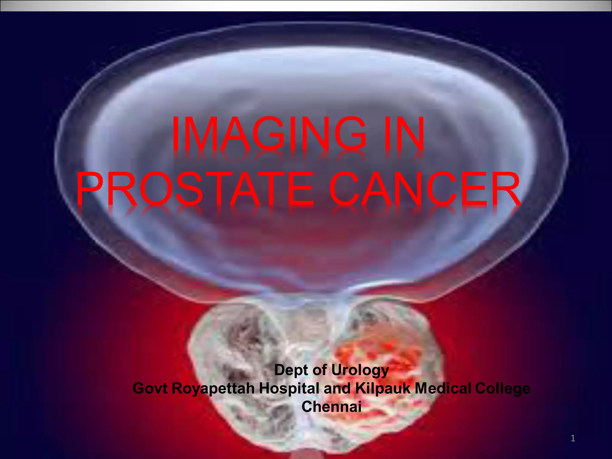 Prostate carcinoma- imaging | PDF