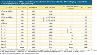Prostate carcinoma- pathology and staging | PDF