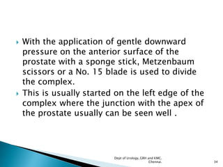 Prostate carinoma- surgery- Open Radical Retropubic Prostatectomy(rrp ...
