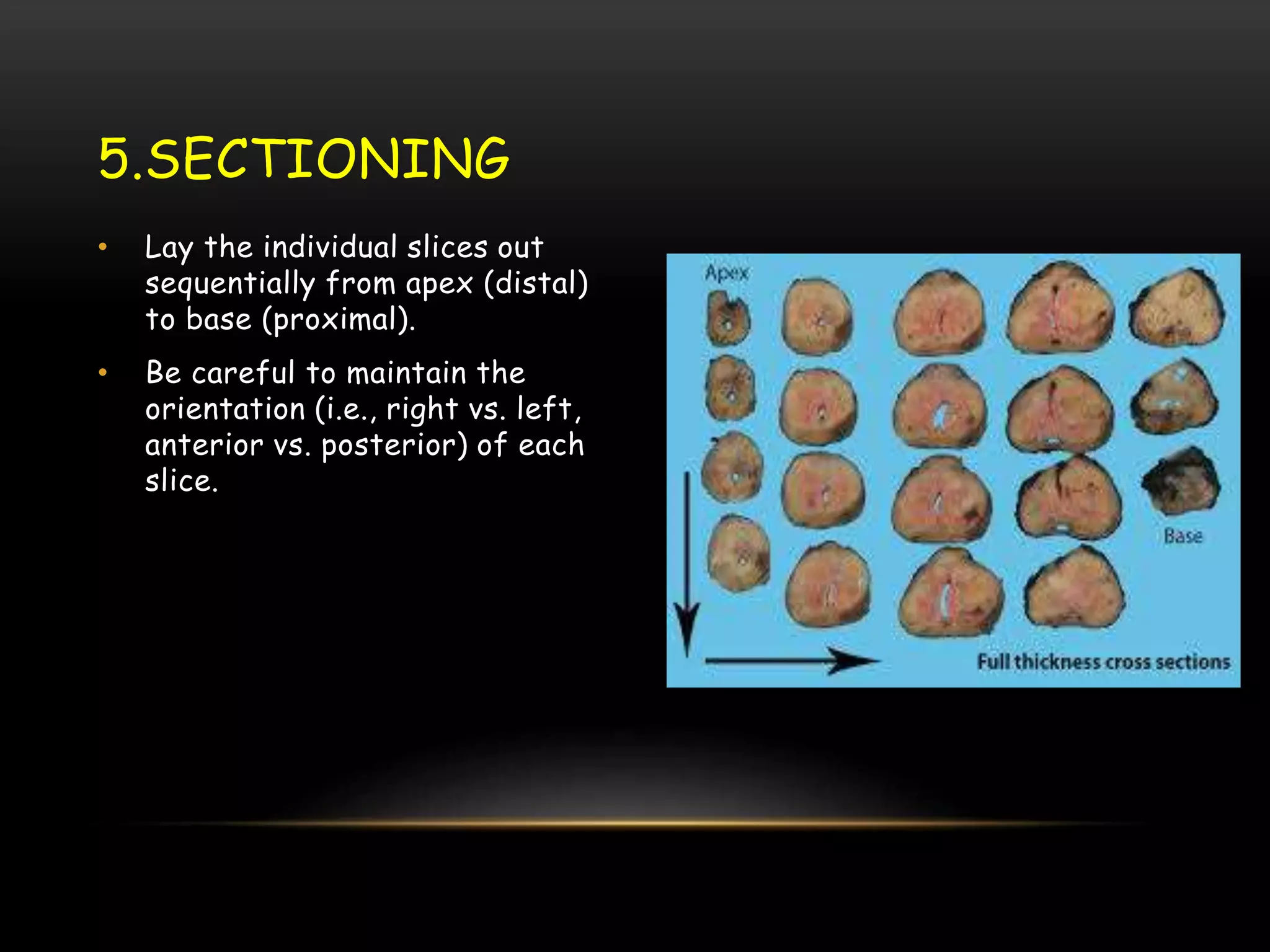 Prostate grossing and reporting | PPTX