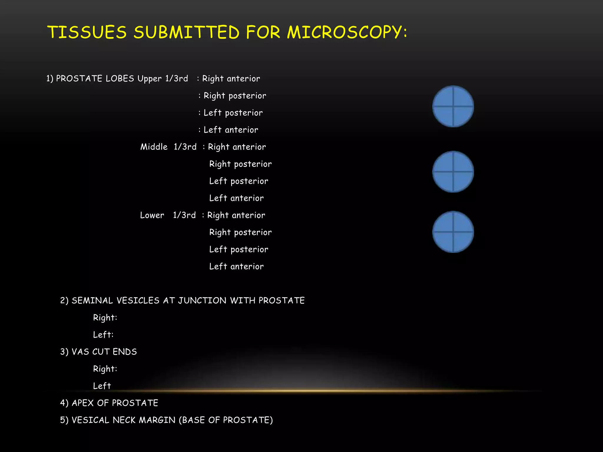 Prostate grossing and reporting | PPTX