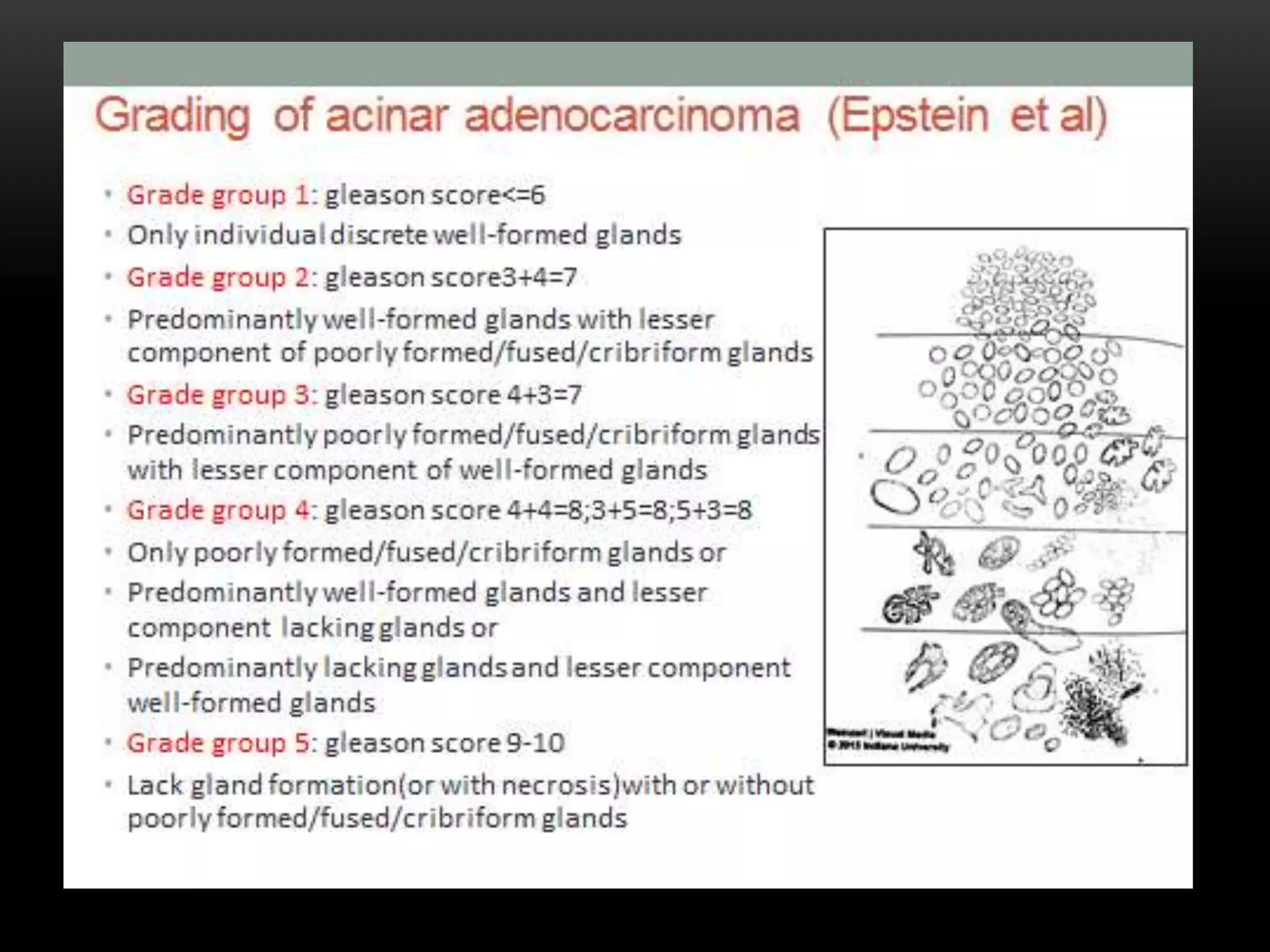 Prostate grossing and reporting | PPTX