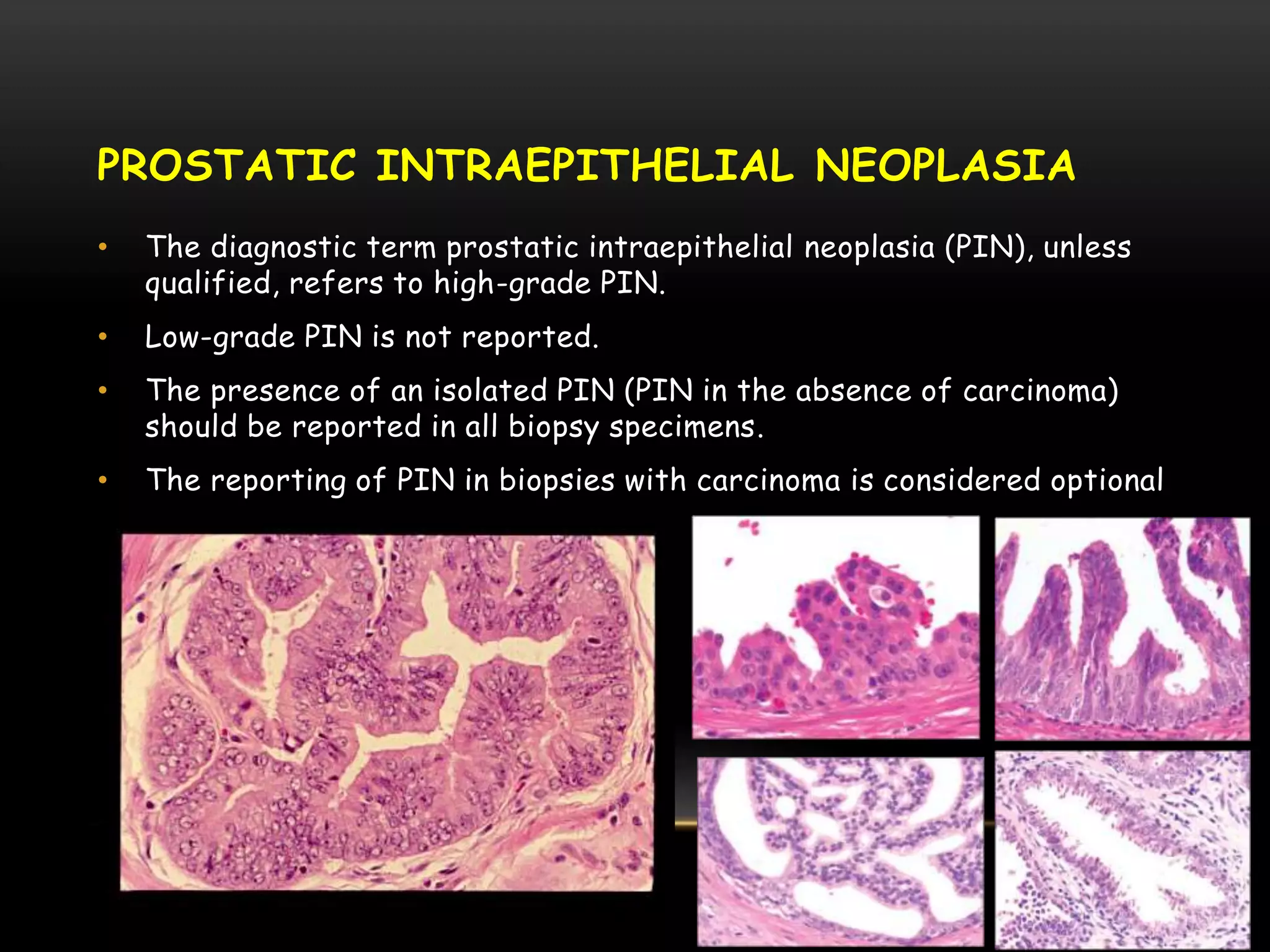 Prostate grossing and reporting | PPTX
