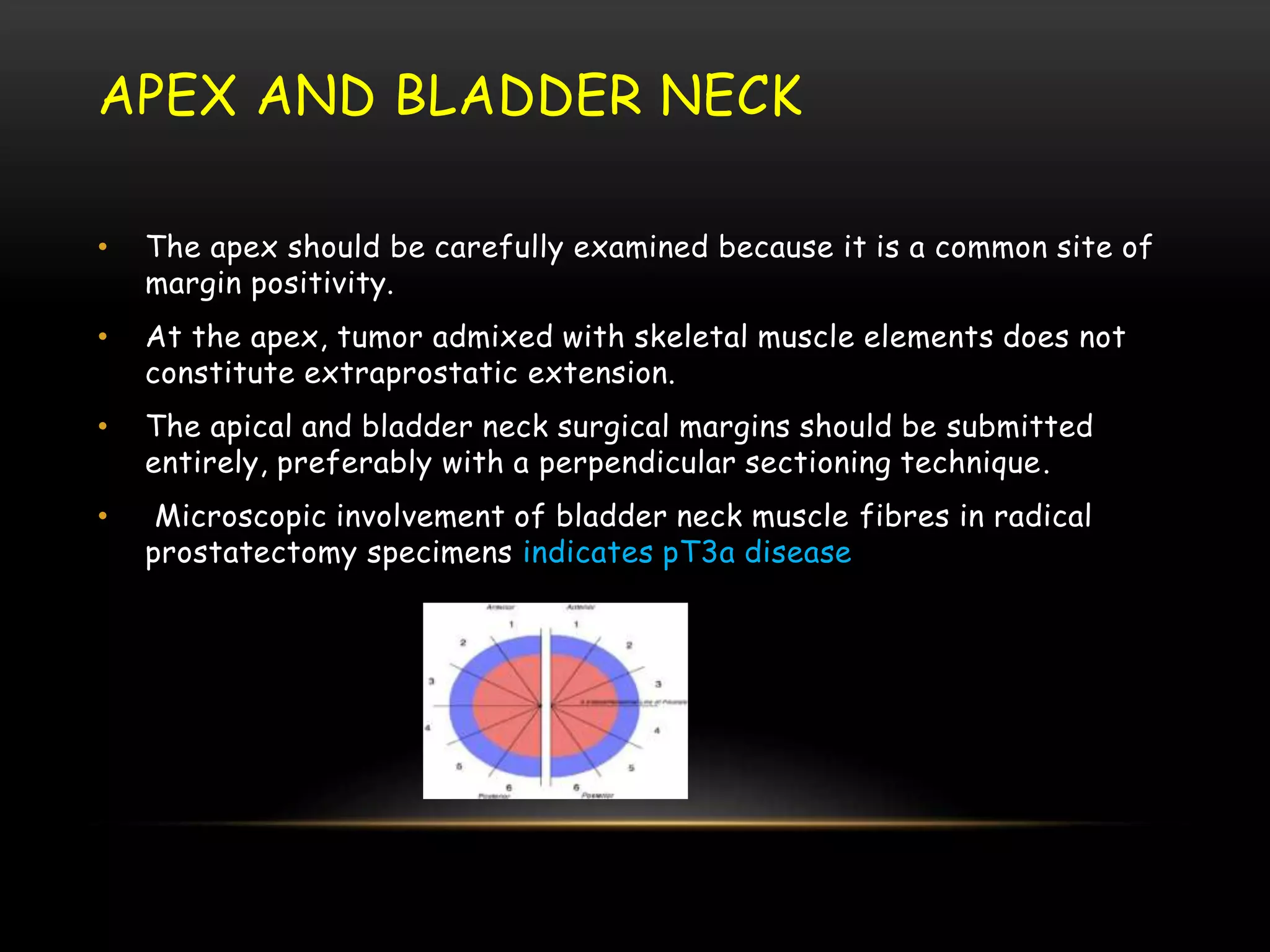 Prostate grossing and reporting | PPTX