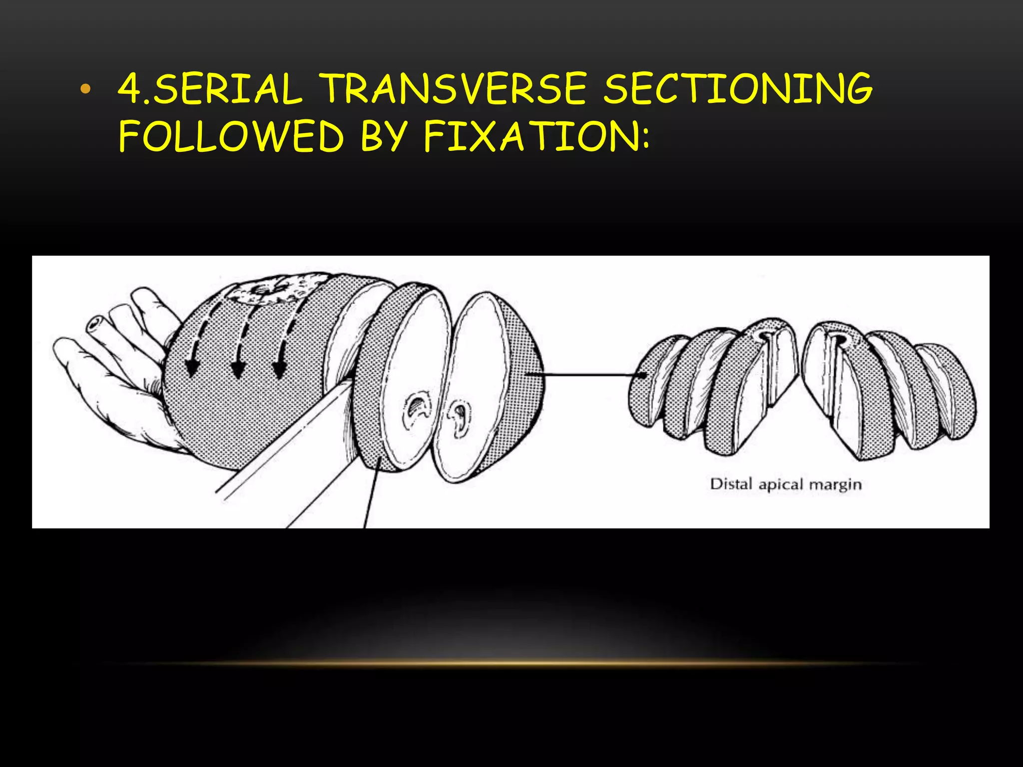 Prostate grossing and reporting | PPTX